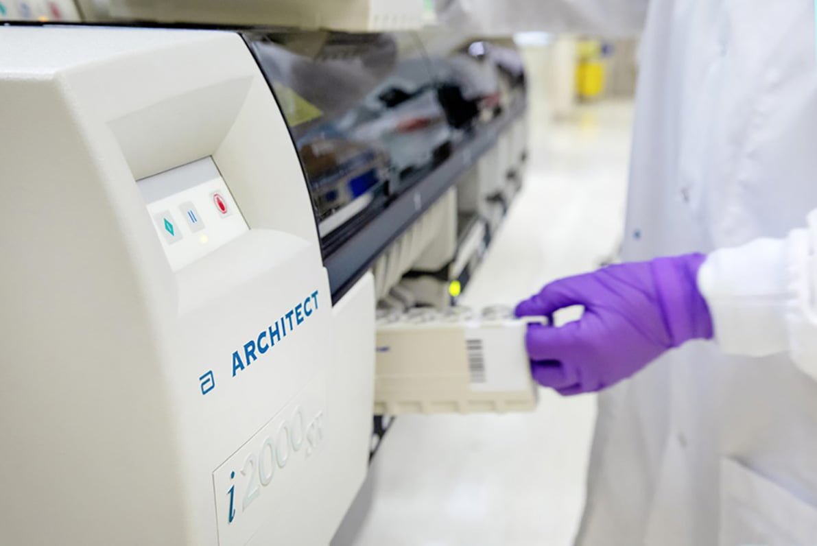 Laboratorio (Abbott) HU Son Espases (Mallorca) | CIECA